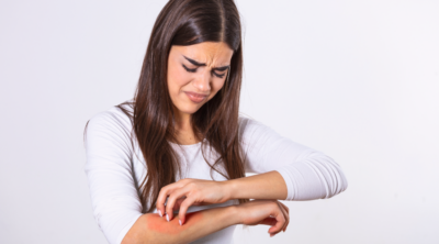 Body Itching: Understanding the Causes and Treatment