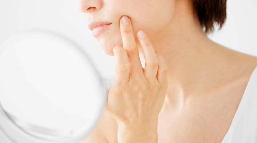 White Spots On Skin How To Treat Them HealthKart