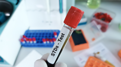 STD Testing: Everything You Need To Know - HealthKart