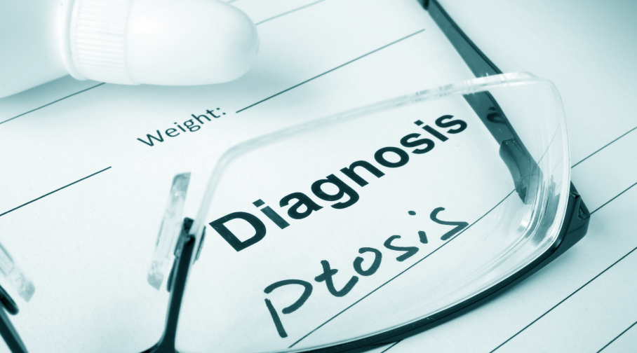 Ptosis Causes and Prevention: All You Should Know - HealthKart