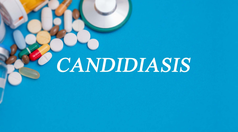 Candidiasis: Symptoms, Causes, and Treatment - HealthKart