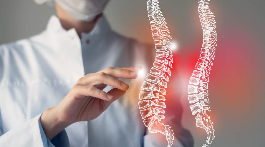 Lordosis: A Look into Its Causes and Solution - HealthKart