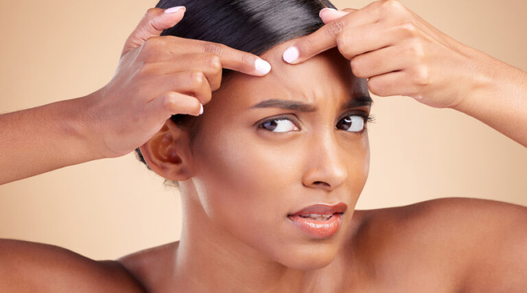 Pimples on Head: Causes and Effective Remedies - HealthKart