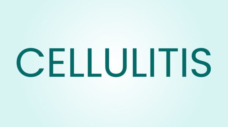 Cellulitis: Symptoms, Causes, and Treatment - HealthKart