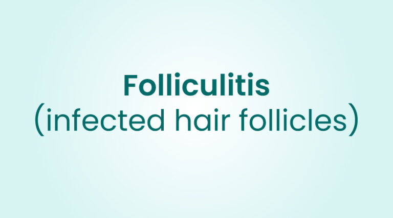 Folliculitis: All About Its Symptoms and Remedies - HealthKart