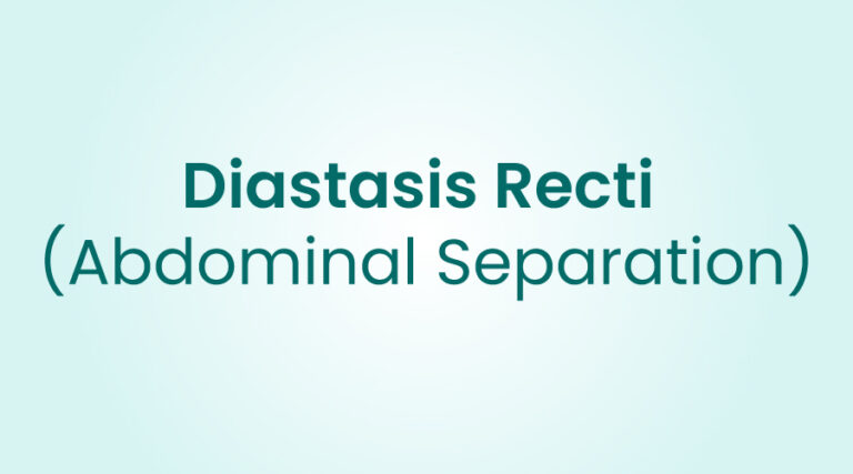 Diastasis Recti (Abdominal Separation): All You Need to Know