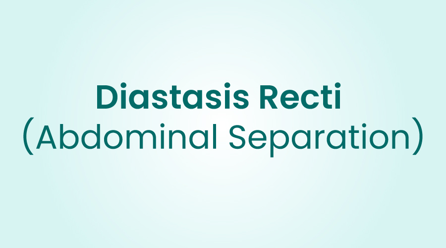 Diastasis Recti (Abdominal Separation): All You Need to Know