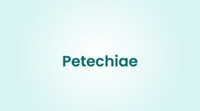 Petechiae: Causes, Treatment, and Prevention - HealthKart