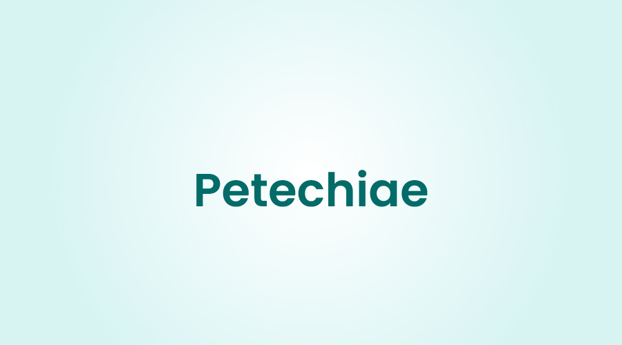 Petechiae: Causes, Treatment, and Prevention - HealthKart