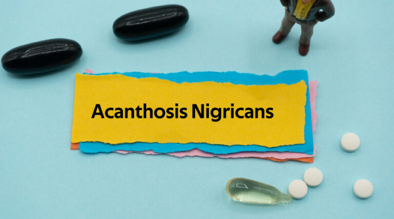 Acanthosis Nigricans Explained: Causes and More - HealthKart