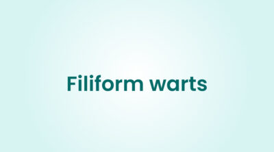 Filiform Warts: Here’s All You Need to Know - HealthKart