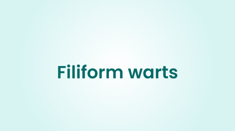 Filiform Warts: Here’s All You Need to Know - HealthKart