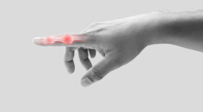 Swollen Fingers: What's the Cause and Remedy? - HealthKart