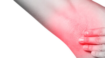 Armpit Pain: Causes, Signs, and Treatment - HealthKart