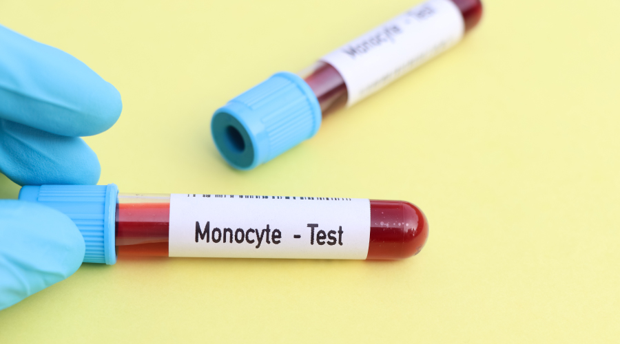 Monocytes: Normal Range, Causes, and Treatment - HealthKart