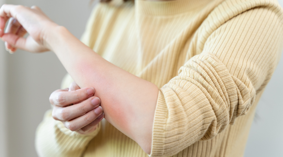 Causes and Effective Treatment of Skin Redness